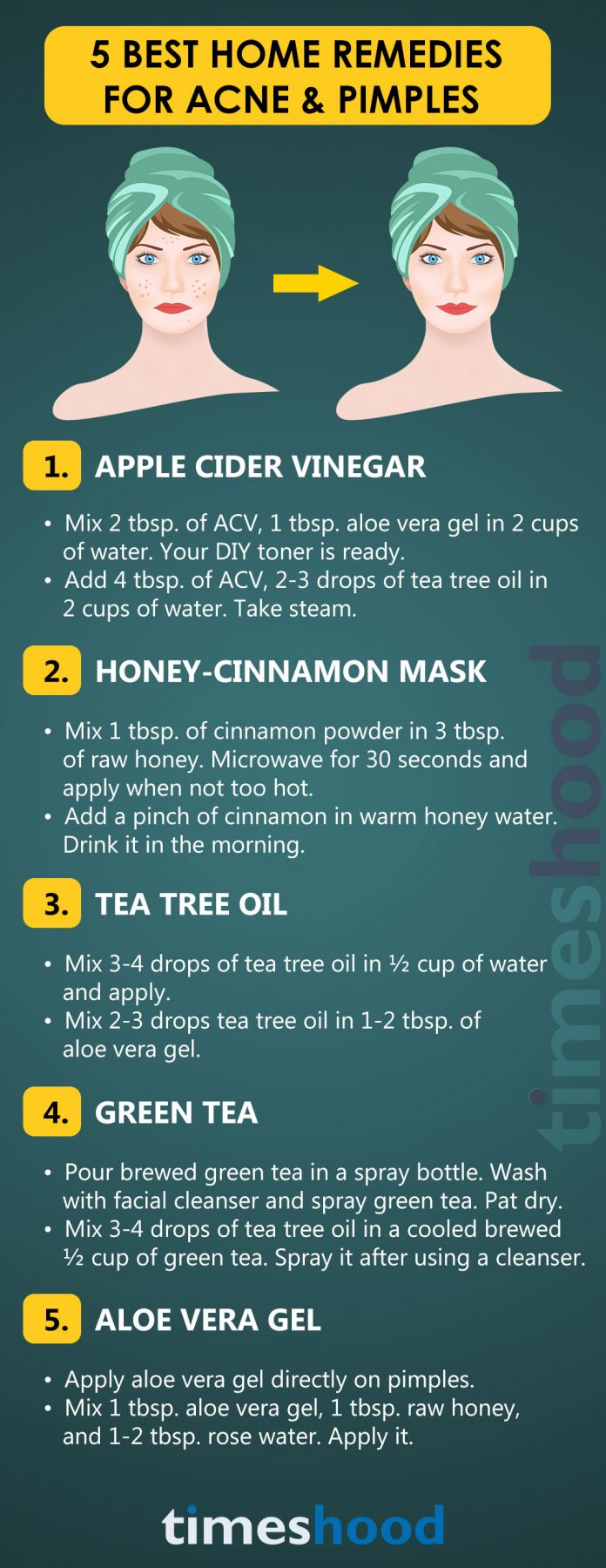Top 5 Home Remedies to Get Rid of Acne Fast - TIMESHOOD