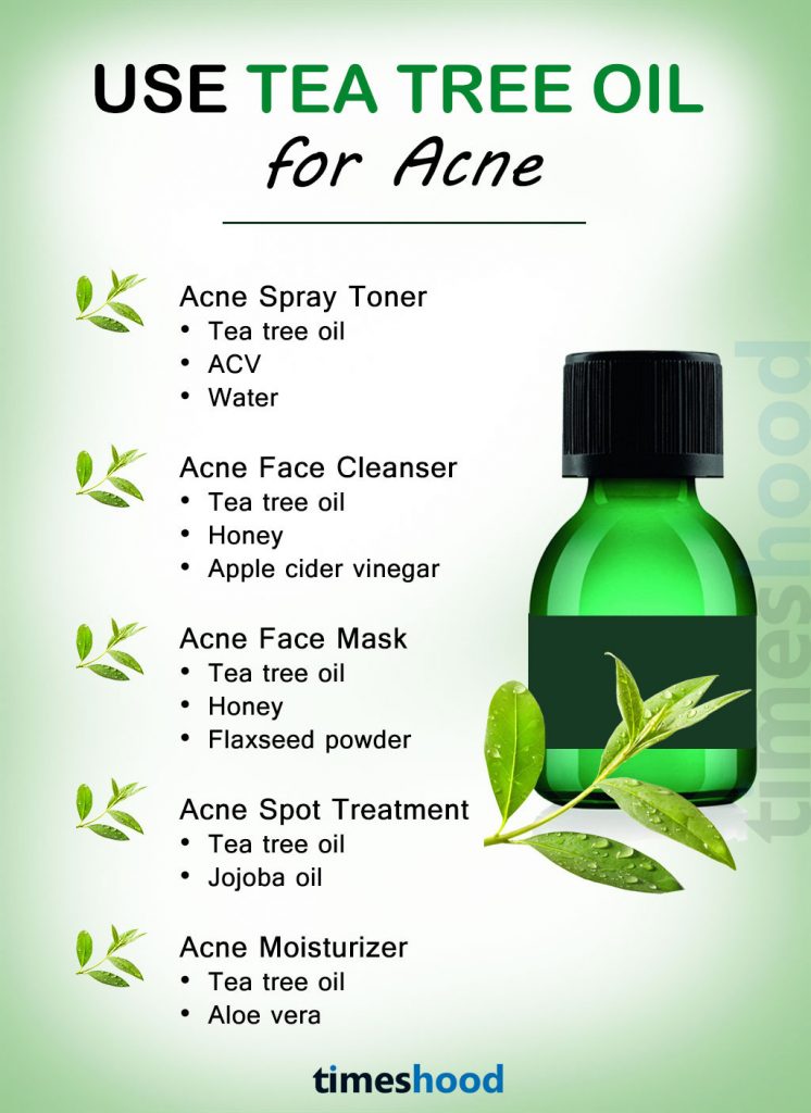 Top 5 Home Remedies to Get Rid of Acne Fast - TIMESHOOD
